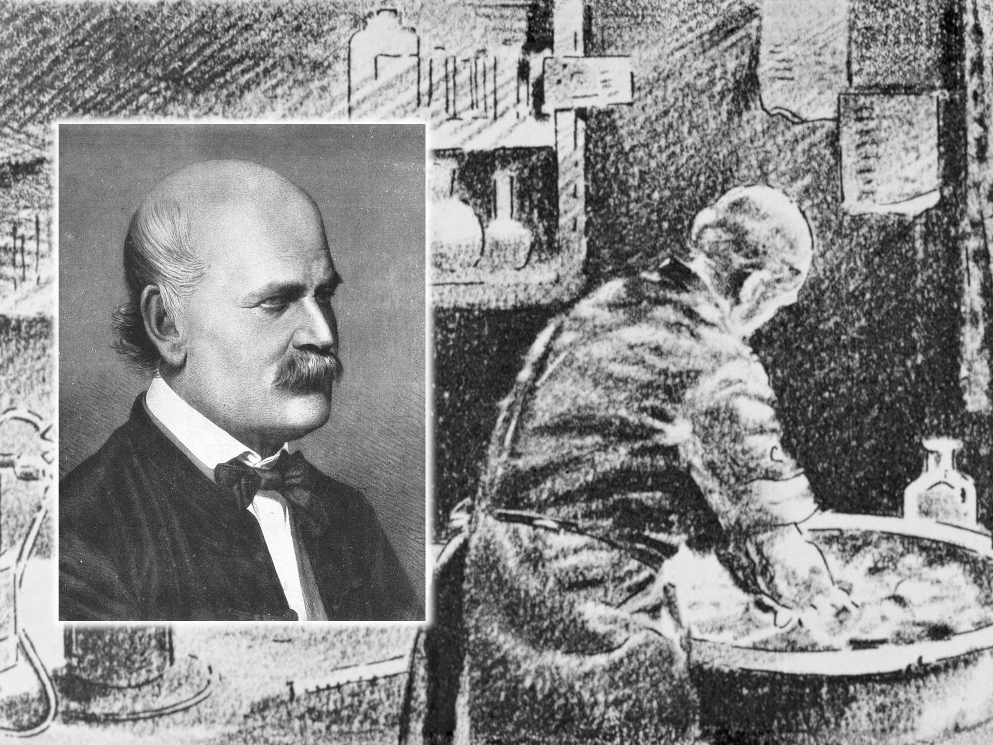 Episode 91: The Tragedy of Ignaz Semmelweis – Half-Arsed History